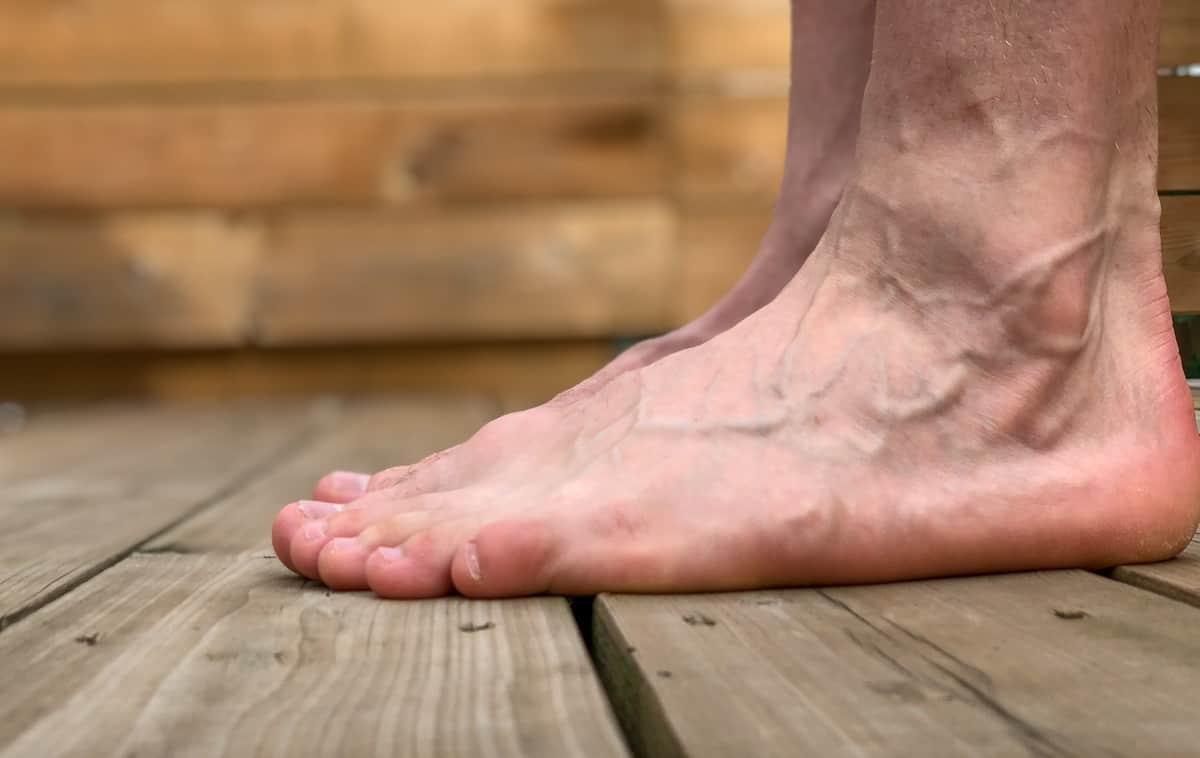 Common Foot Conditions in the Elderly