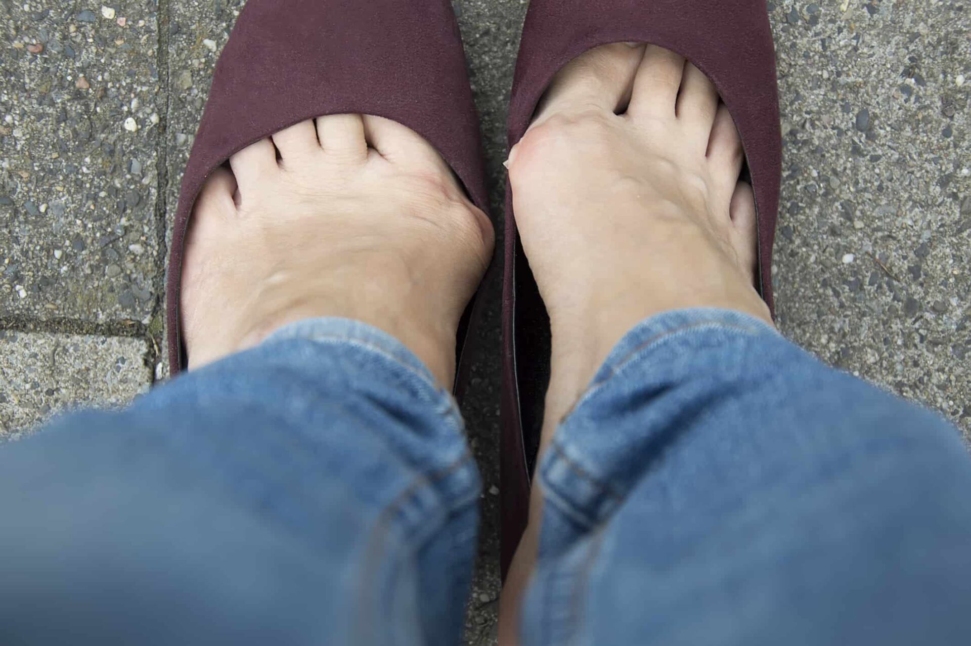How to Find Shoes for Wide Feet - Feet First Clinic