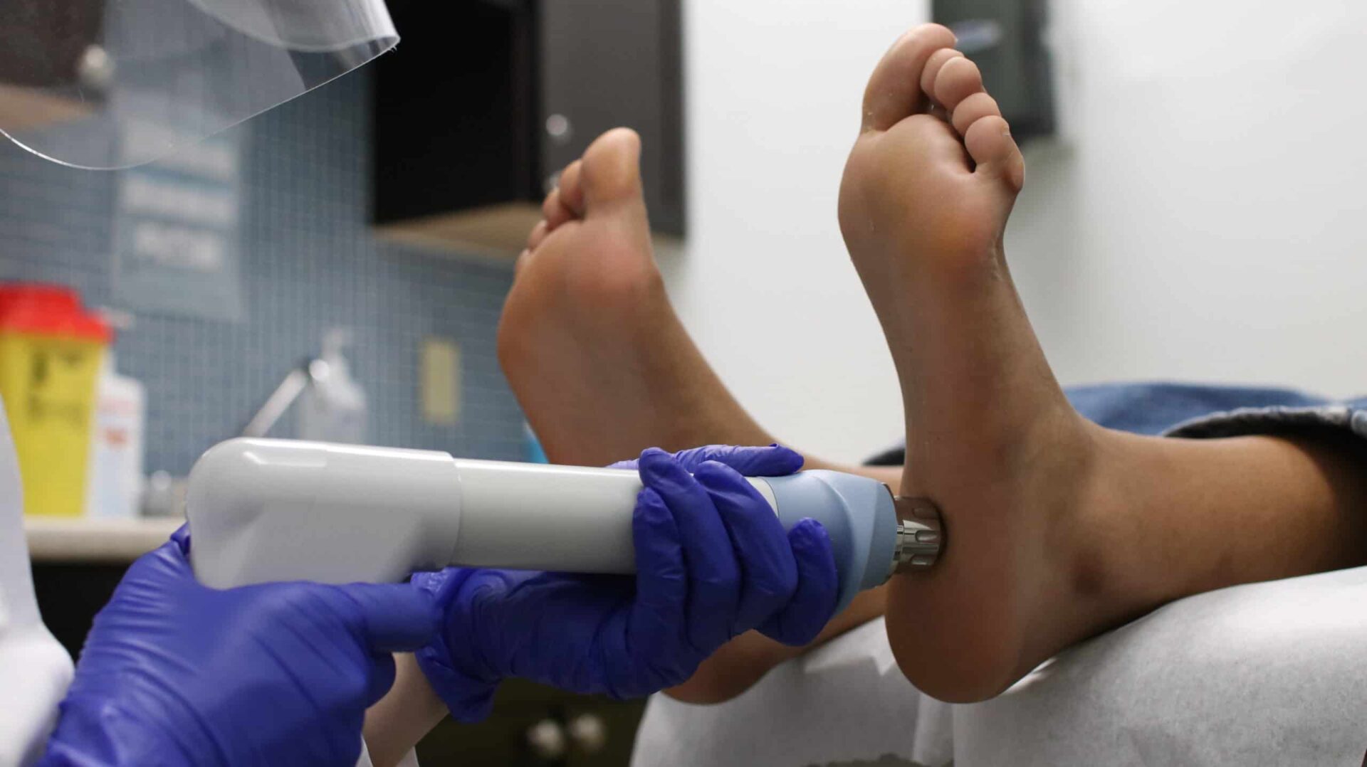 What to Expect During Shockwave Therapy - Feet First Clinic