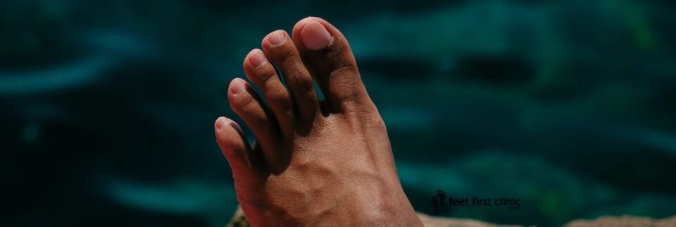Stubbed Toe: What To Do When It Happens - Feet First Clinic