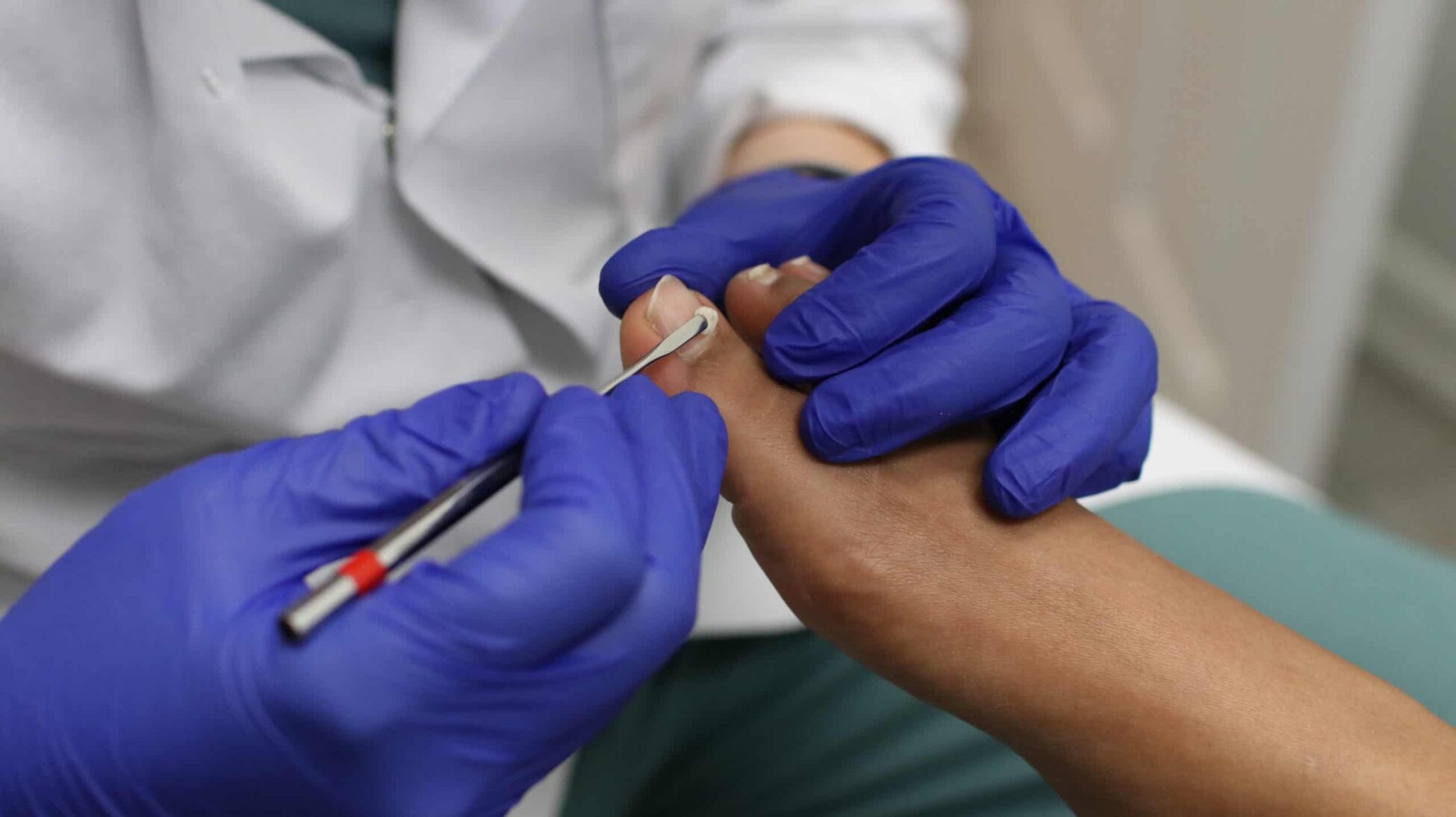 Onyfix - Feet First Clinic