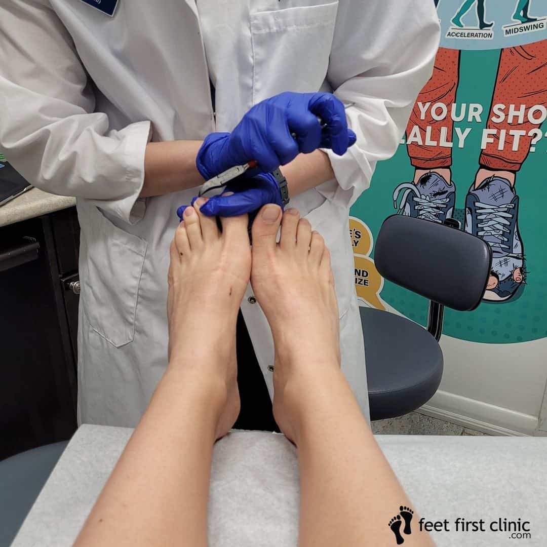 What Does a Foot Clinic Do? - Feet First Clinic