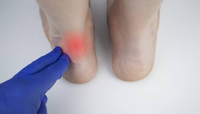 Help! My Toenail is Falling Off! - Feet First Clinic