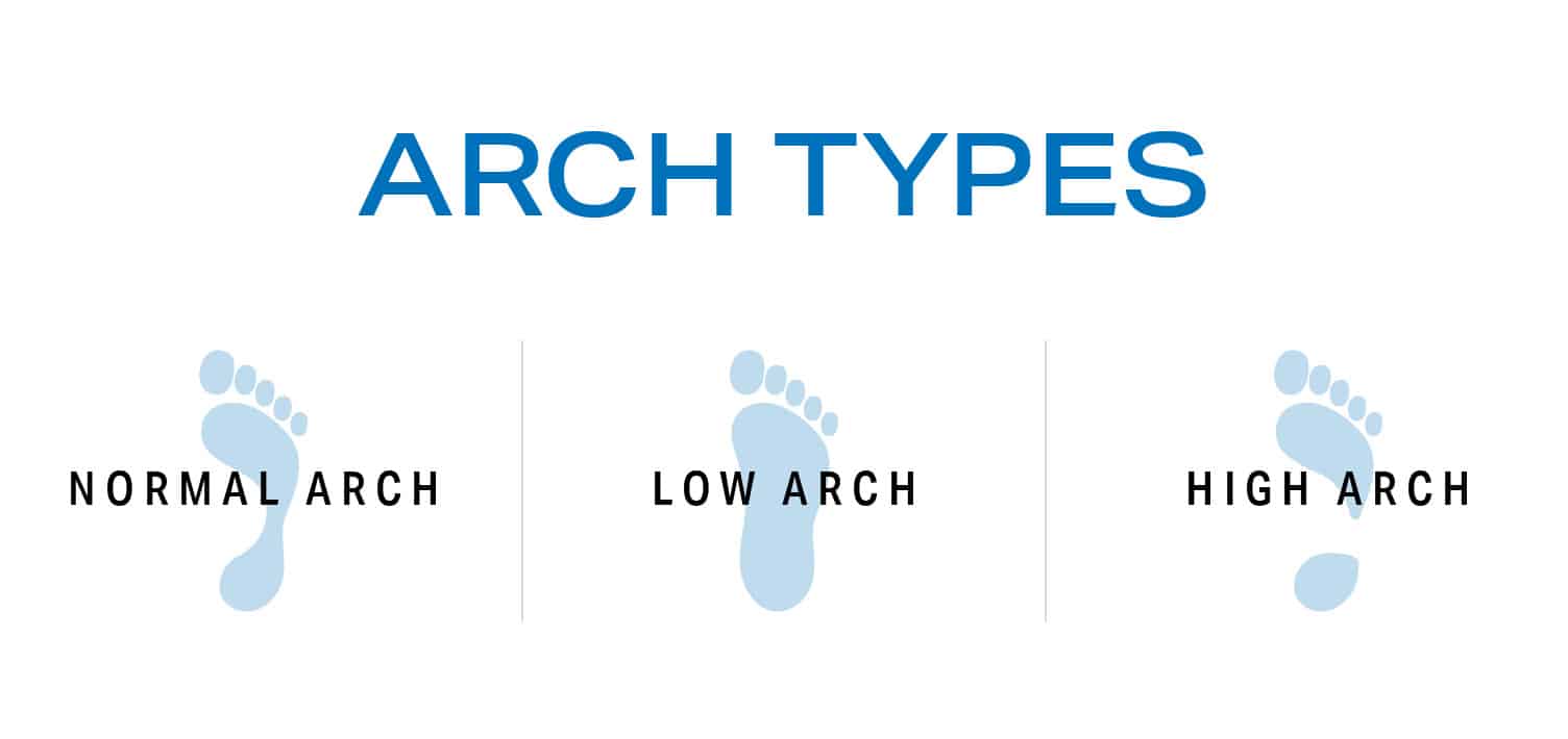 Are Flat Feet A Problem? - Feet First Clinic