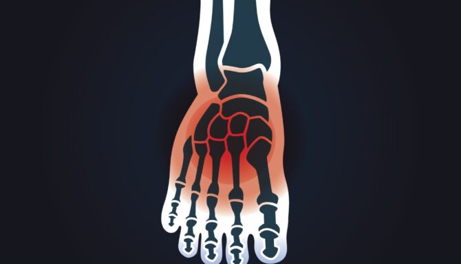 I Have Curled Toes — Is There Something Wrong? - Feet First Clinic