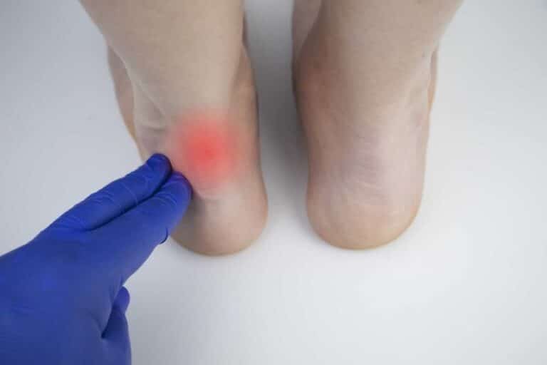 Foot Pain: Causes and Treatment - Feet First Clinic