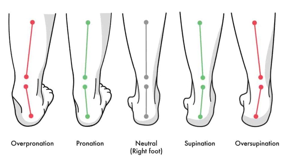Biomechanical Analysis for Improved Foot and Ankle Function - Feet ...