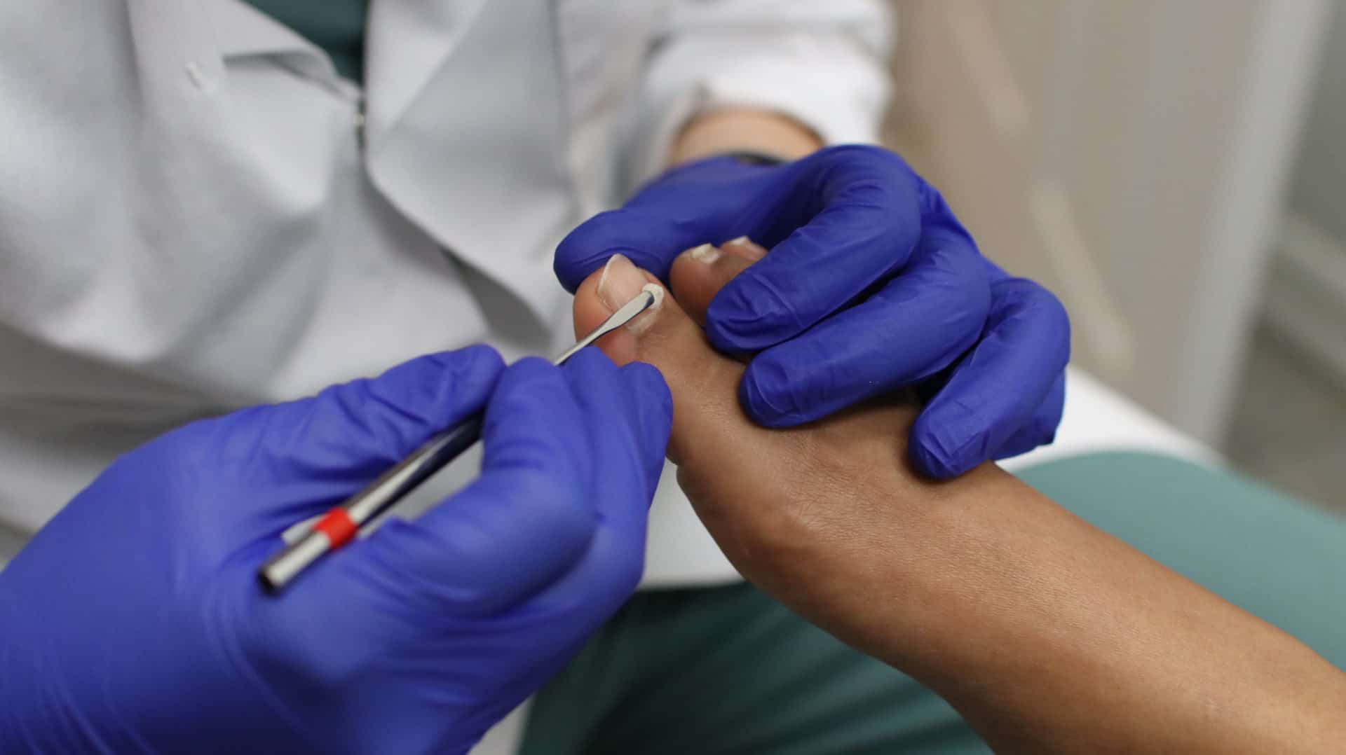 Onyfix - Feet First Clinic