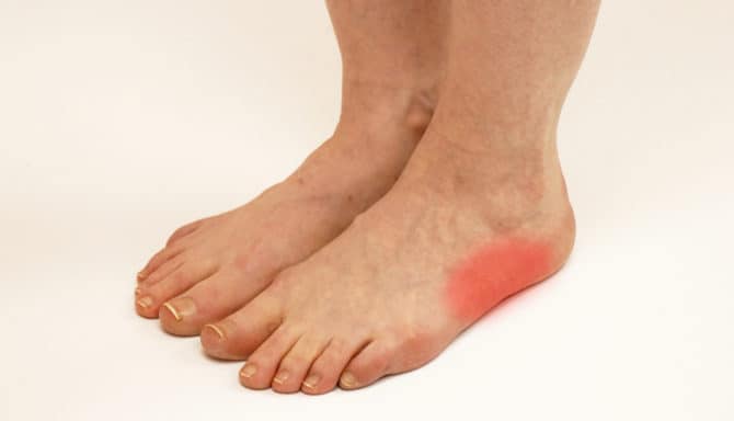 What Makes Winter Footwear Unique: Key Features - Feet First Clinic