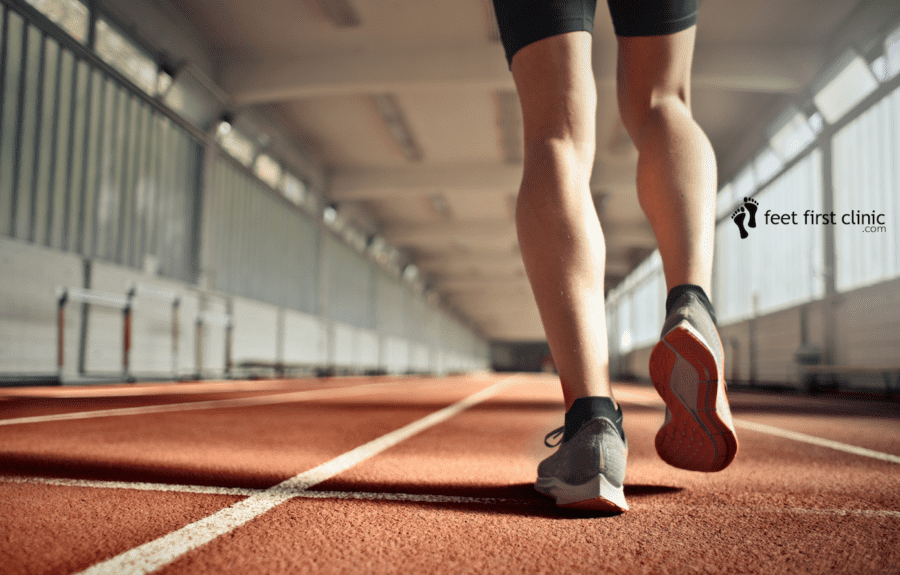 Everything You Need To Know About High Arched Feet - Feet First Clinic