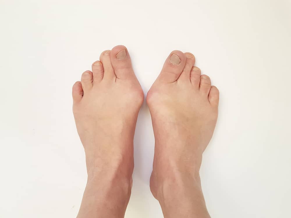 Red Toes: Should You Worry? - Feet First Clinic