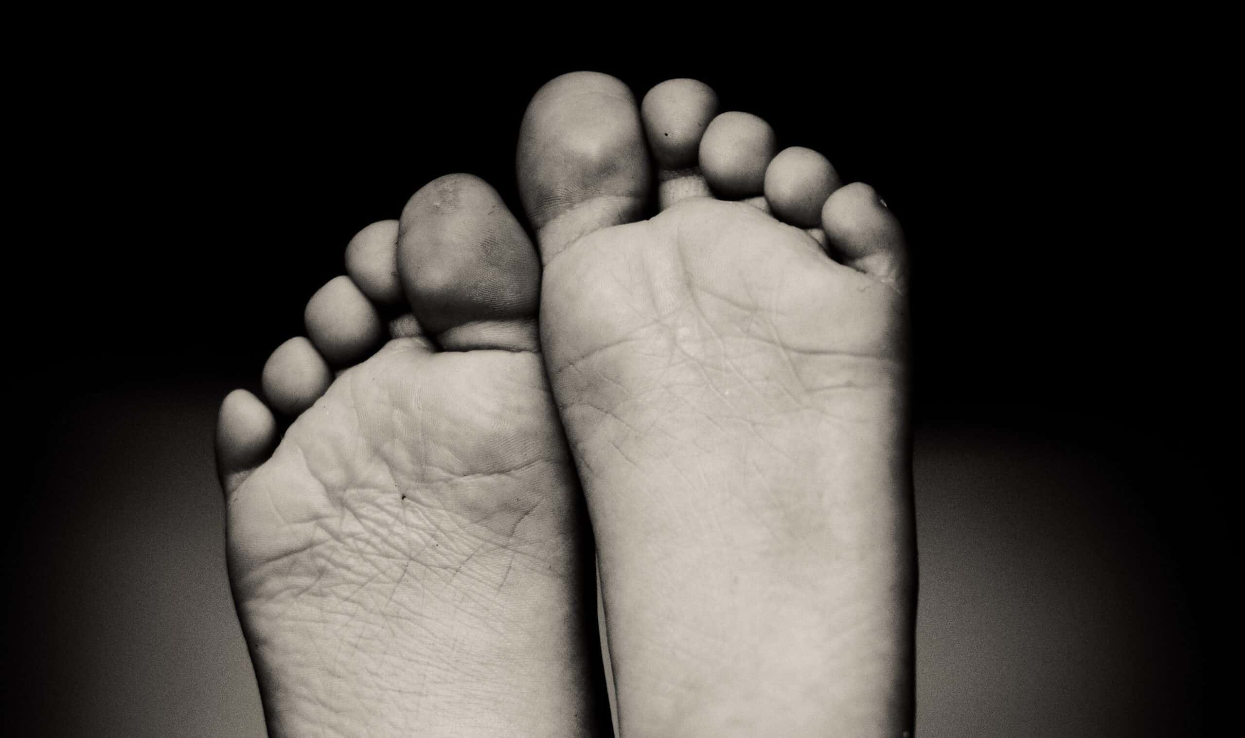 4 Reasons You Have Pain on the Bottom of Your Foot - Feet First Clinic