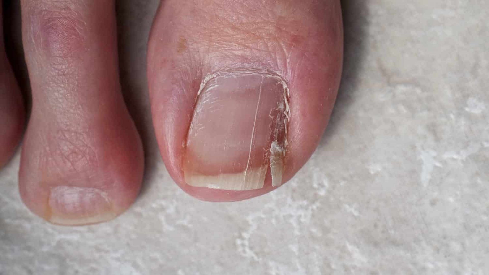 Common Foot Conditions | Foot Specialist Toronto | Feet First Clinic