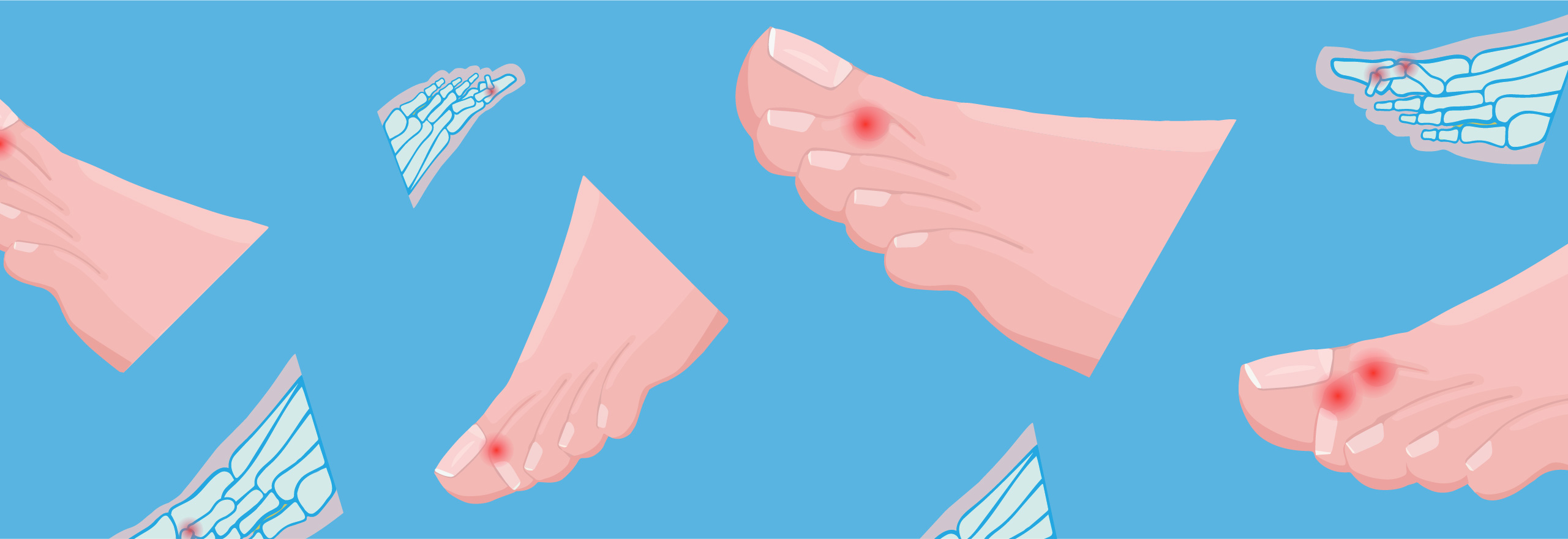 The Anatomy of Toe Deformities | Feet First Clinic