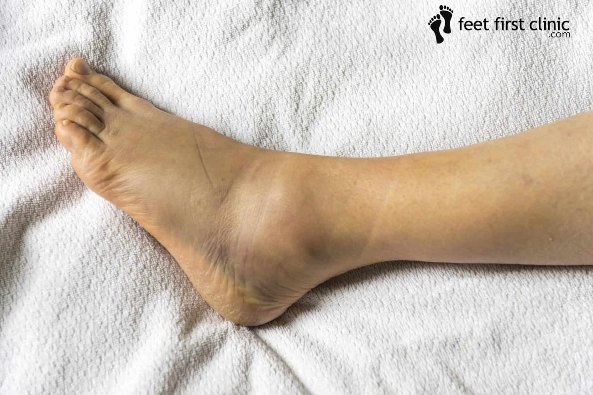 Is My Foot Pain Urgent? - Feet First Clinic