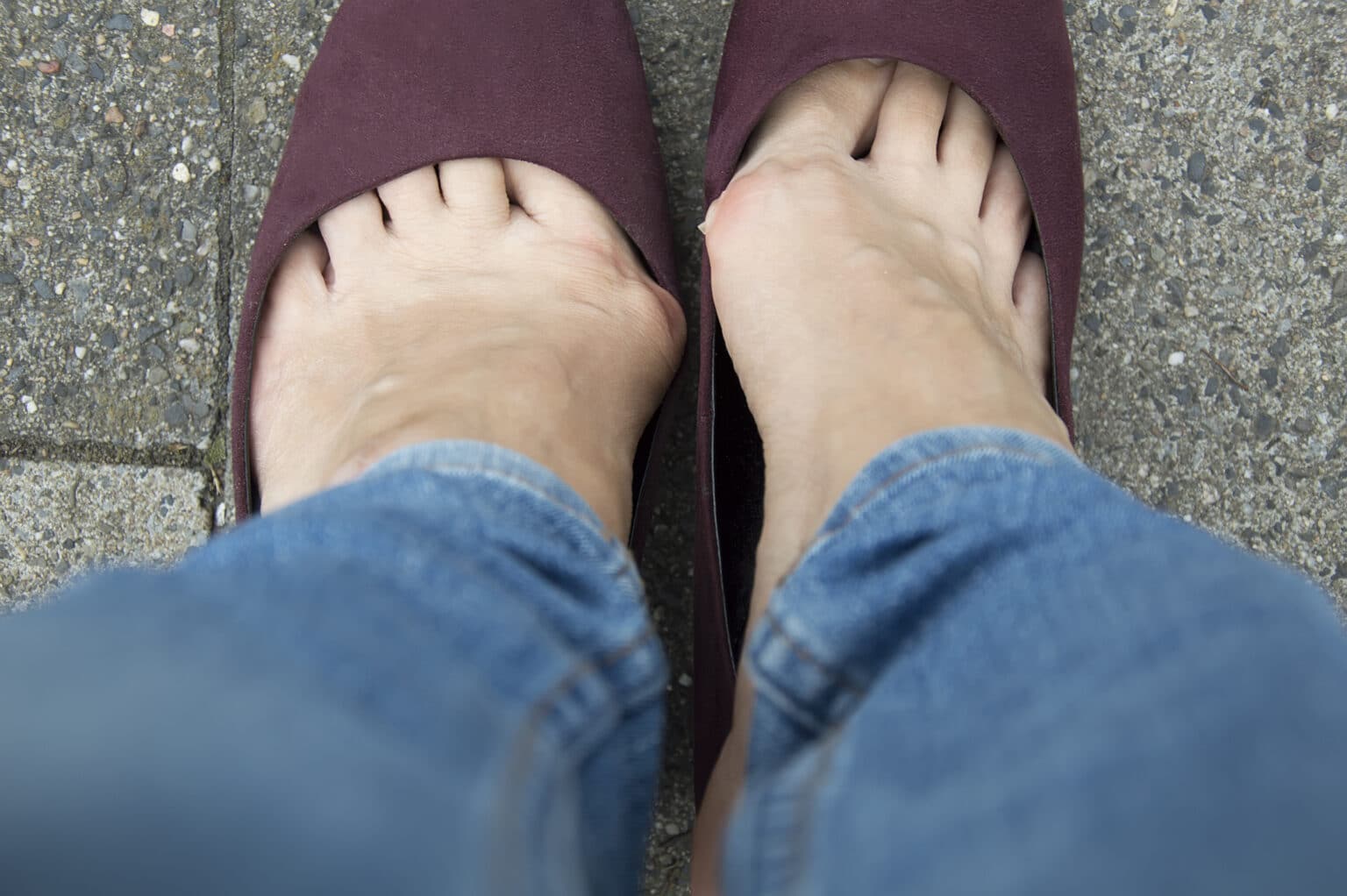 High-Heel Health: Protecting Your Feet in Heels - Feet First Clinic