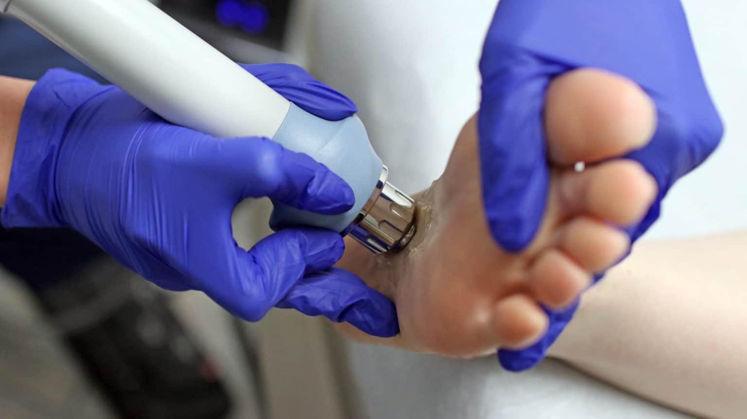 What to Expect During Shockwave Therapy - Feet First Clinic